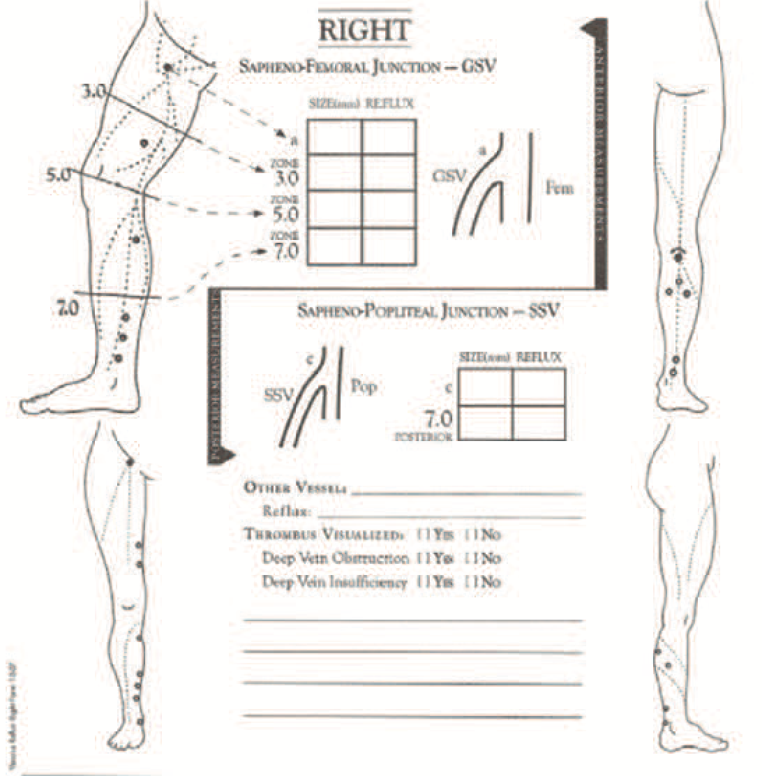 Duplex Ultrasound Technical Considerations for Lower Extremity Venous ...