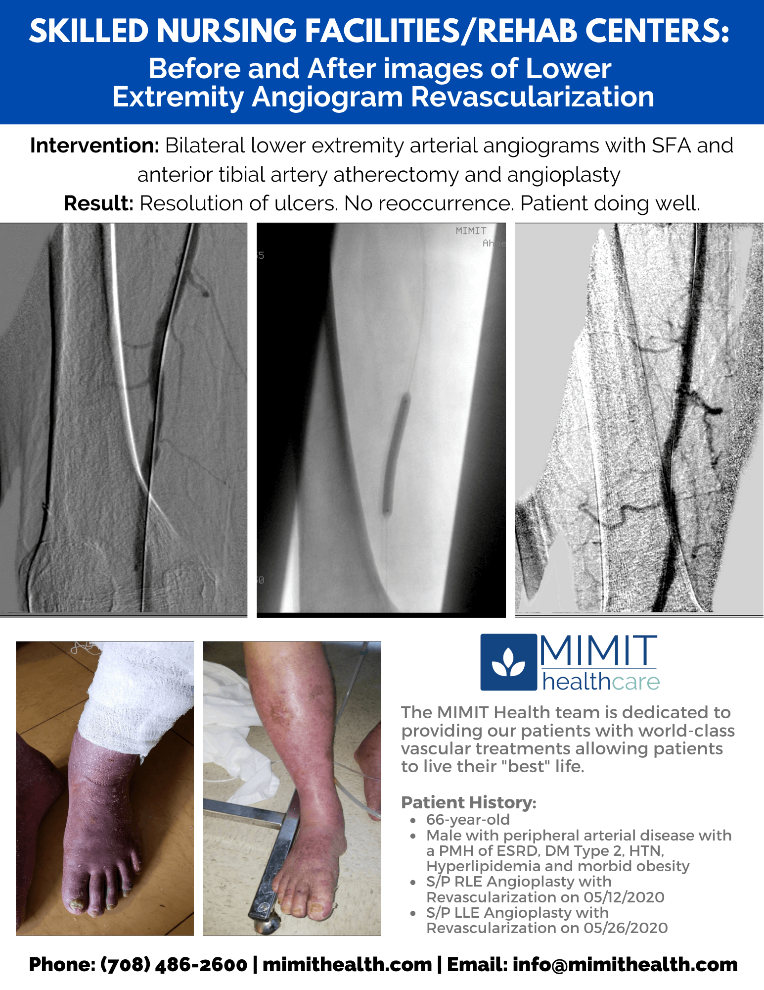 T.F Peripheral Artery Disease Case Study