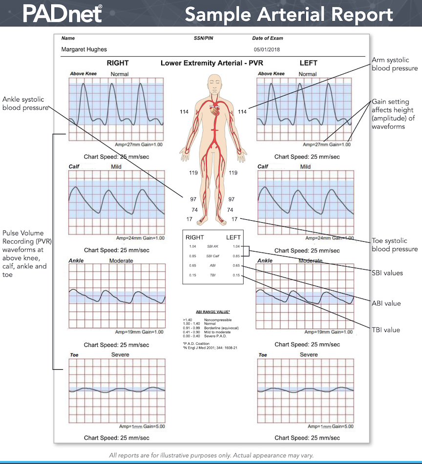 PADnet non-invasive testing Vascular - arterial and venous- Basics