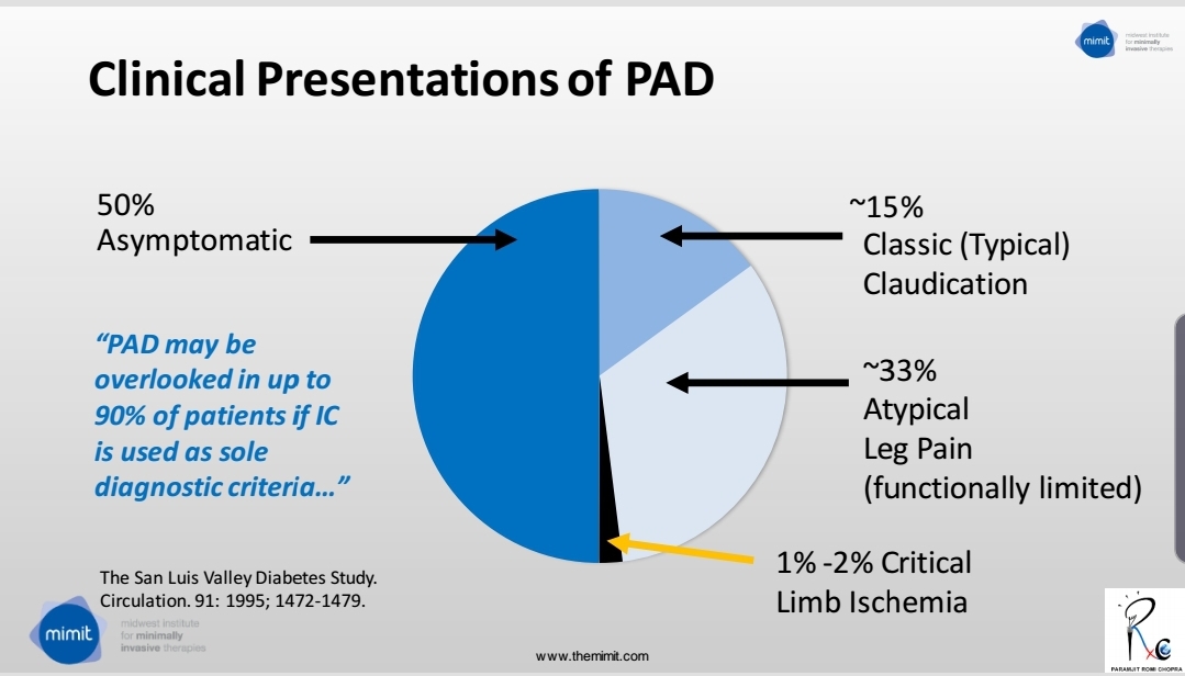 Overview of Peripheral Artery Disease (PAD) - How to diagnose and treat ...