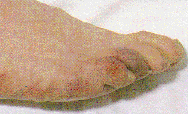 Vascular Physical examination of a patient - notes and MIMIT- EHR ...