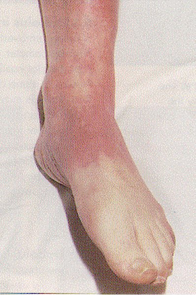 Vascular Physical examination of a patient - notes and MIMIT- EHR ...