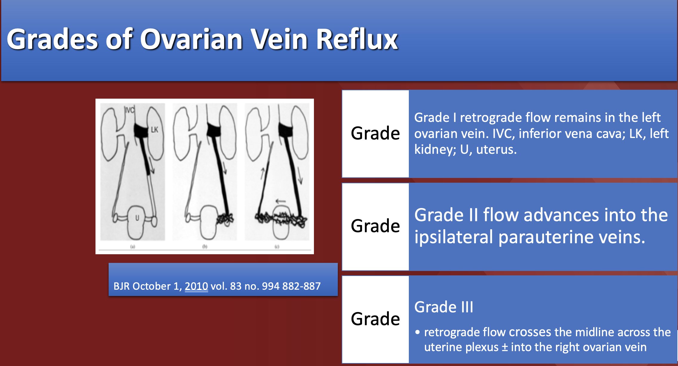 pelvic congestion syndrome - presentations by Dr Paramjit "Romi Chopra, MD